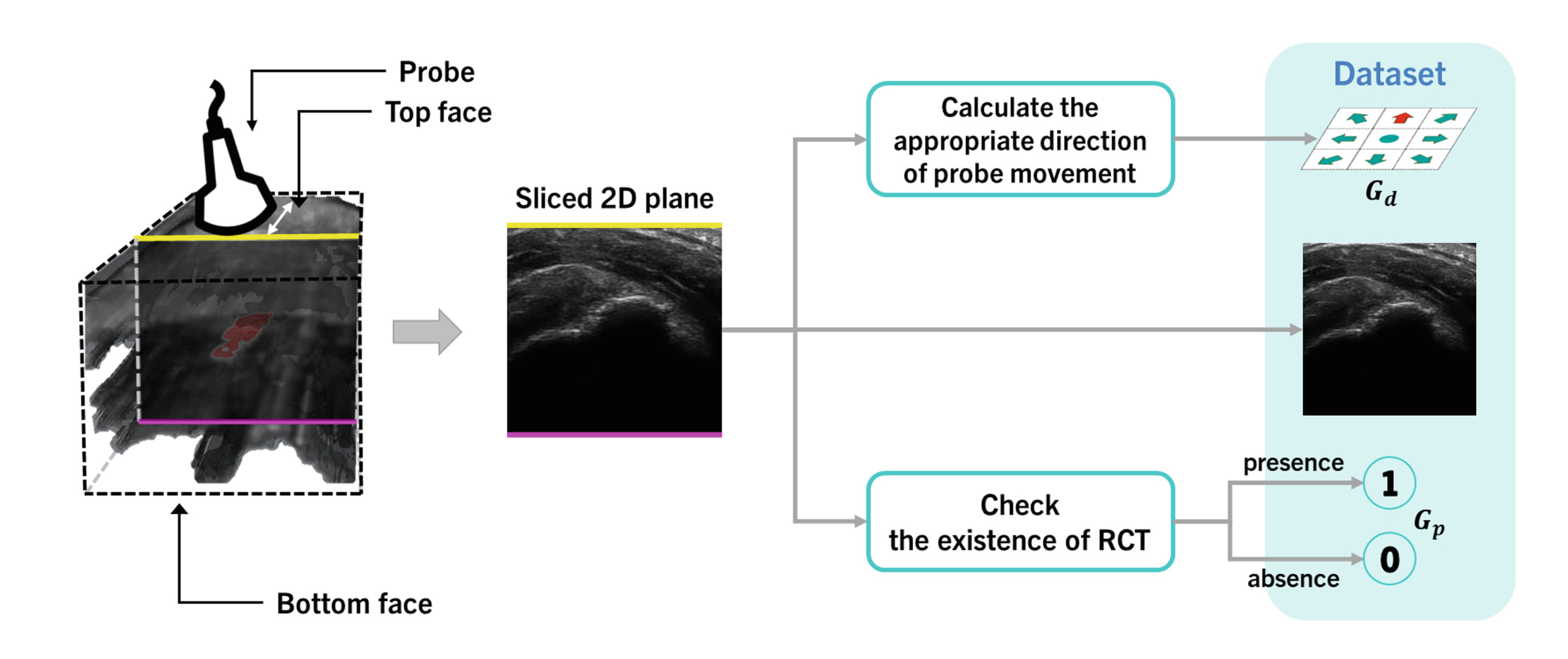 USG-Net: Deep Learning-based Ultrasound Scanning-Guide for an Orthopedic Sonographer | MacsLAB